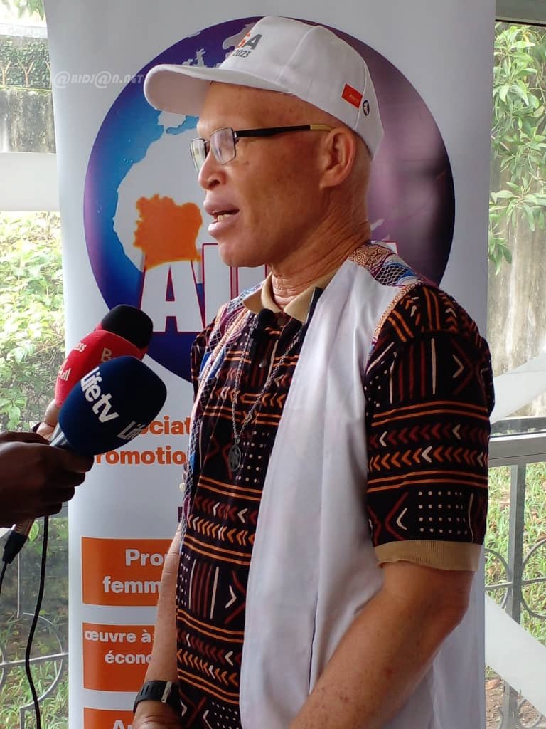 Lutte contre l'albinisme : des stratégies pour la protection des ...