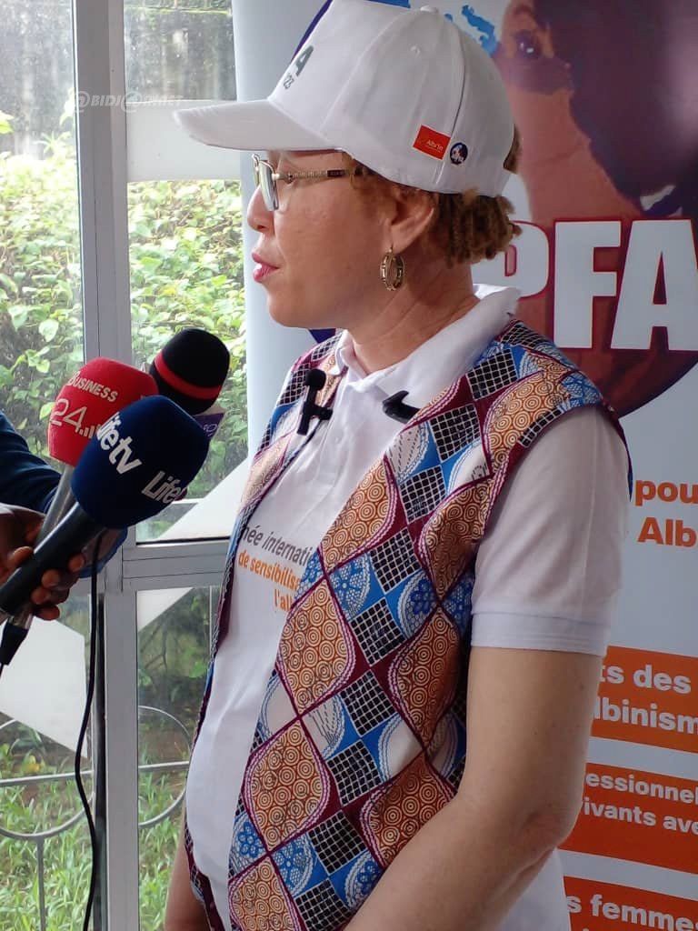 Lutte contre l'albinisme : des stratégies pour la protection des ...